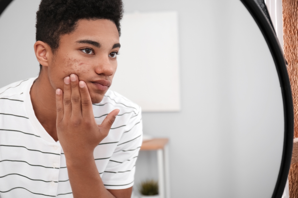 #162 - Using the gut-skin connection to treat acne | Integrative ...